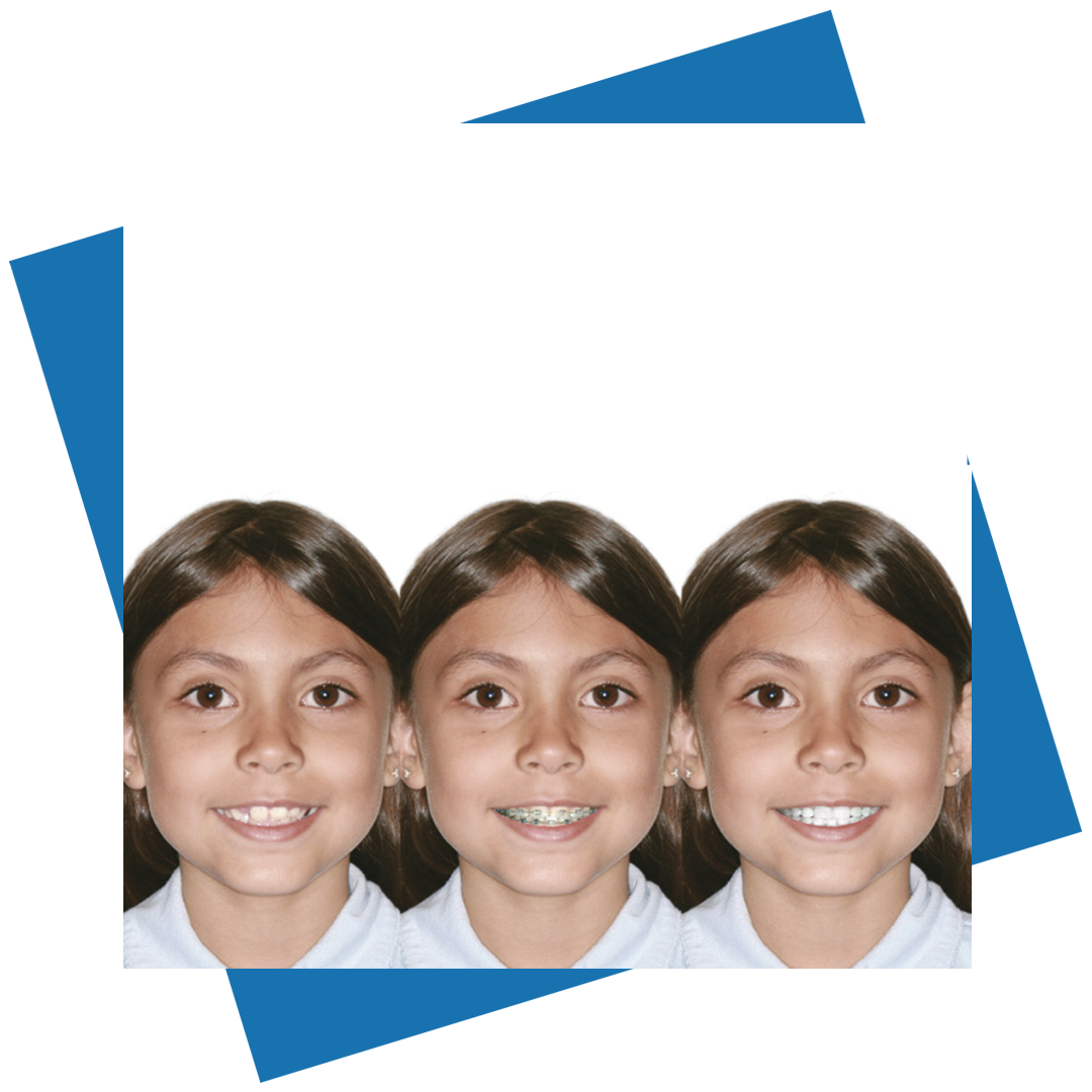 Dolphin 2D – Dolphin Imaging | El Software dental preferido por los ...