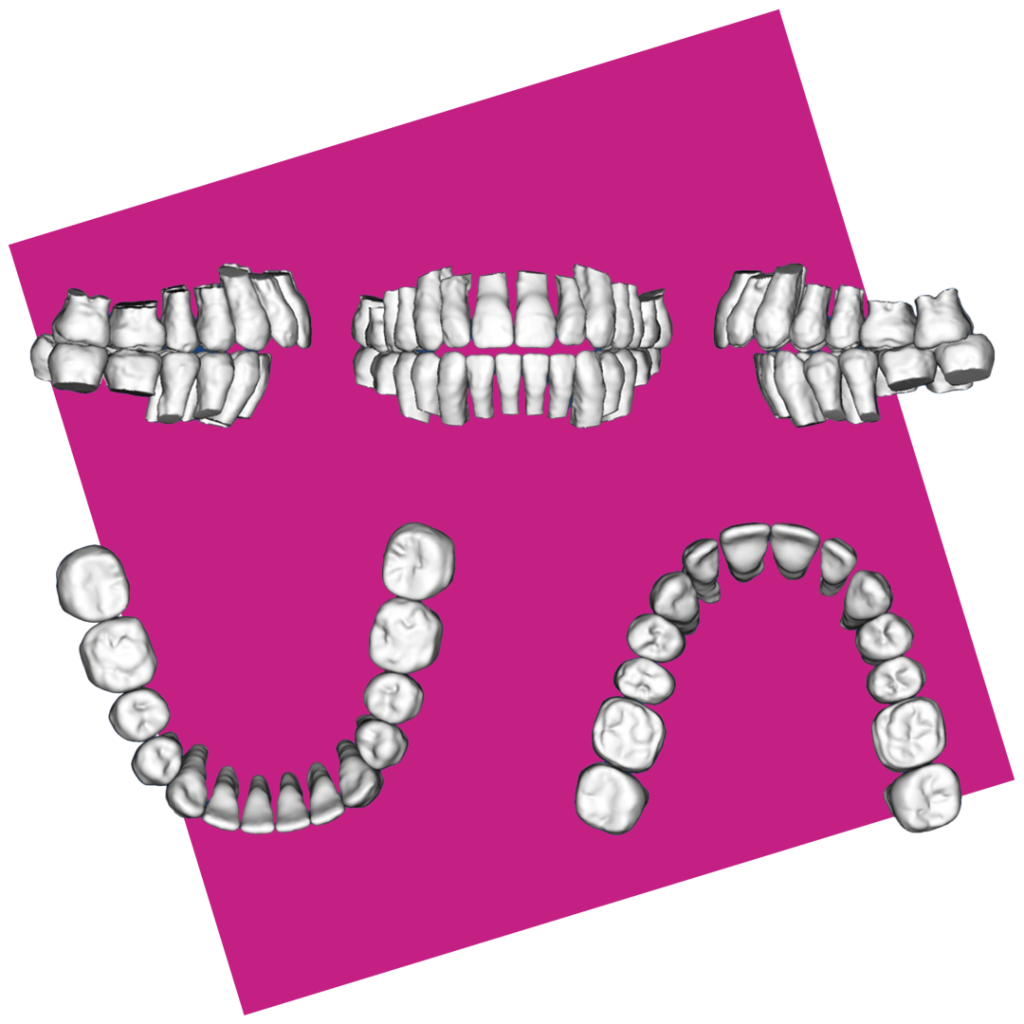 Dolphin 3d – Dolphin Imaging | El Software dental preferido por los ...