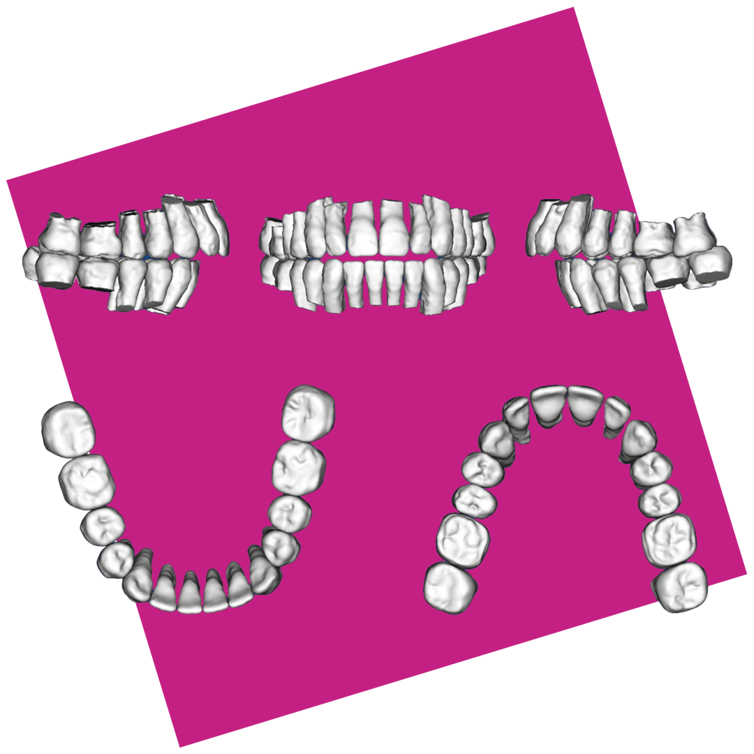 Dolphin 3d – Dolphin Imaging | El Software dental preferido por los ...